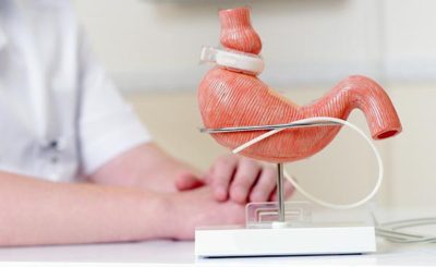 Lap Band System | Dr Rekkas | General Robotic and Bariatric Surgery